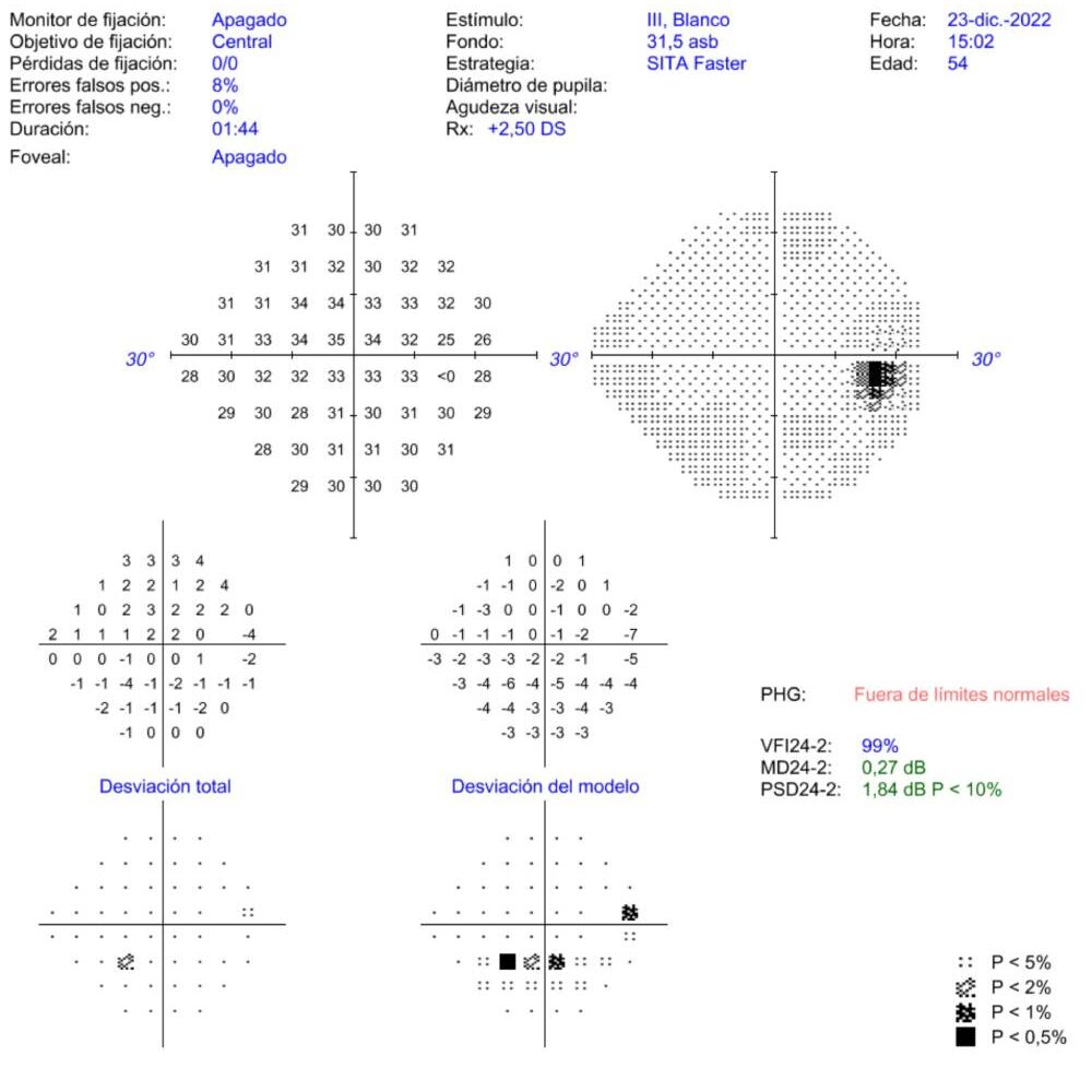 Campimetria - Dr. Alfredo Ferrer